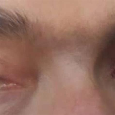 Chromatogram Is Showing The Homozygous Mutation C 5069‐1g C In The Download Scientific Diagram