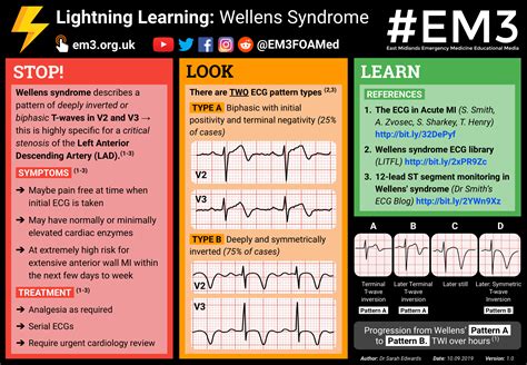 Lightning Learning Wellens Syndrome — Em3