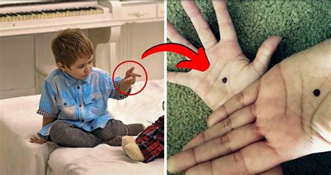 Mom Bathes Adopted Son For The First Time Then She Sees Something Strange On His Palms And