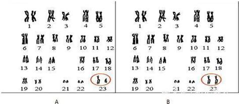 性别总共分四种，天真的你是不是还以为只有雌雄两种性别呢？ 双性人 雌雄 性别 新浪新闻