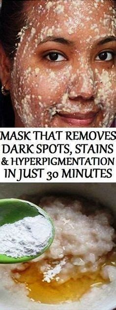 Get Rid Of Face Stains Make Your Skin Shiny It S Simple Try IT Remove Dark Spots Dark Spots