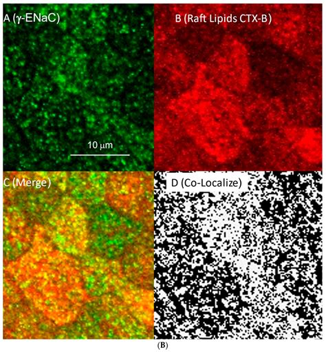 Pip2 Interacts Electrostatically With Marcks Like Protein 1 And Enac In Renal Epithelial Cells