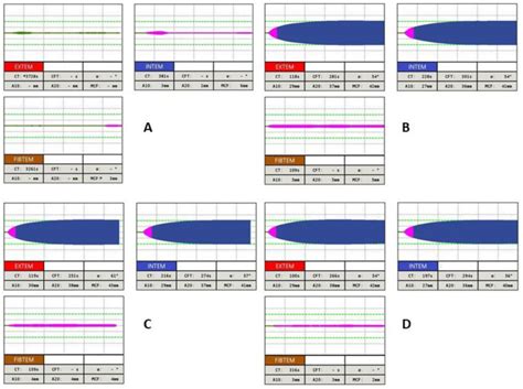 Basic Principles Of Rotational Thromboelastometry Rotem® And The Role