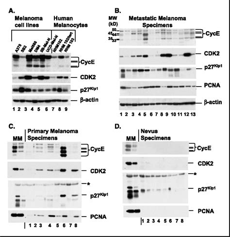 Figure 1 From The Low Molecular Weight Cyclin E Isoforms Augment Angiogenesis And Metastasis Of