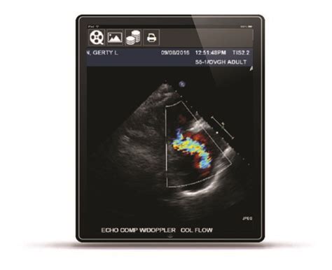 Exa Enterprise Imaging Konica Minolta Healthcare Americas Inc