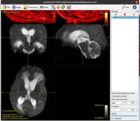 Error When Coregister The T1w To The Diffusion Image Preprocessing Mrtrix3 Community