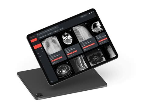 Dicom Viewer Online Free Web Based Medical Image Viewing 2025