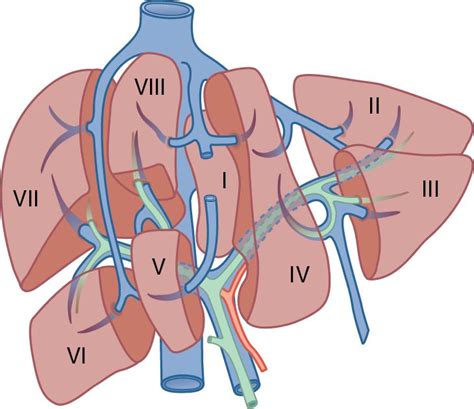 Segmental Resection Clinical Tree