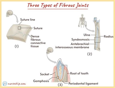 Different Types Of Joints In The Human Body Examples Images Nurseship