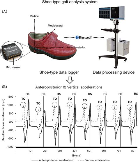 Gait Characteristics In Individuals With Parkinsons Disease During 1 Minute Treadmill Walking