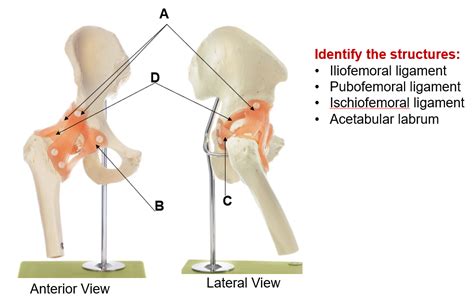 Iliofemoral Ligament Model