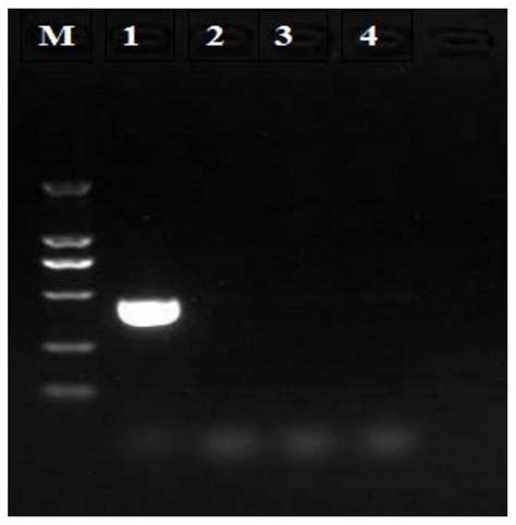 A Black Fungus Strain Specific Molecular Marker Primer Kit And Application Thereof Eureka