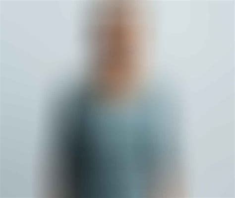 Understanding Fuchs Corneal Dystrophy Symptoms And Treatments