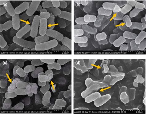 Lactobacillus Plantarum