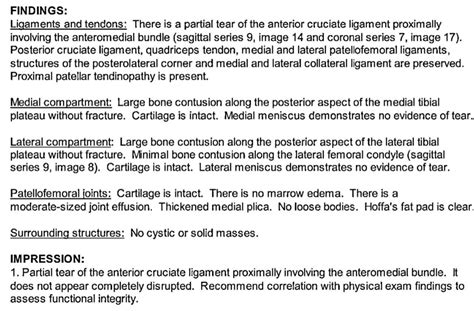 Ok Im Pretty Sure Im Reading This Right… R Acl