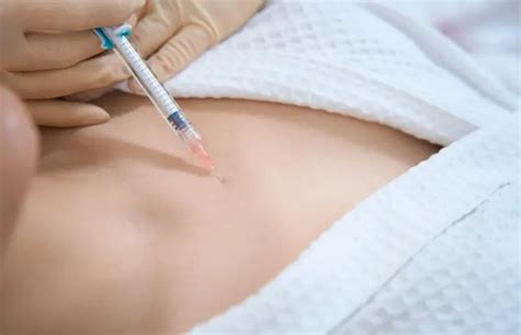 Profhilo Injection Points What Are The 5 Points Maylips