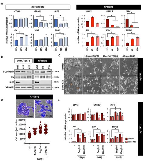 Lack Of Irf6 Disrupts Human Epithelial Homeostasis By Altering Colony Morphology Migration