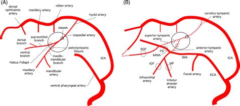 Branches Of Internal Carotid