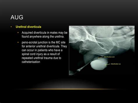 Ascending Urethrogram Pptx