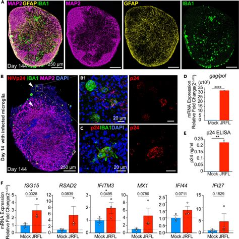 Sustained Type I Interferon Signaling After Human Immunodeficiency