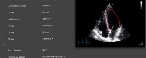 The Future Of Ai Guided Echo Us2 Ai