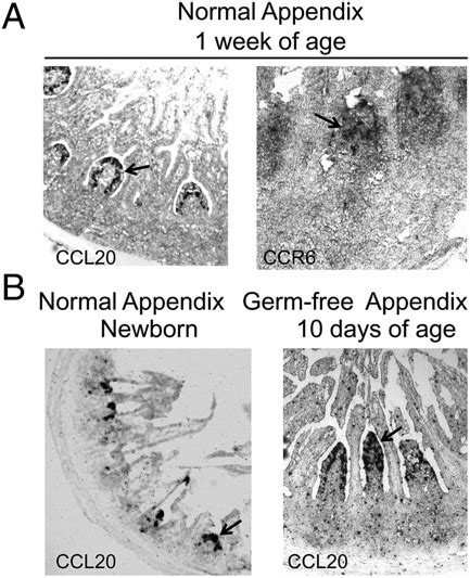 Ccl20 Ish And Ccr6 Immunohistochemistry Of Rabbit Appendix A Ccl20 Ish And Ccr6 Immunohistochemistry Of Rabbit Appendix A