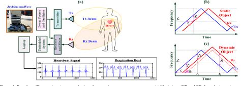Figure 2 From Contactless And Short‐range Vital Signs Detection With Doppler Radar Millimetre