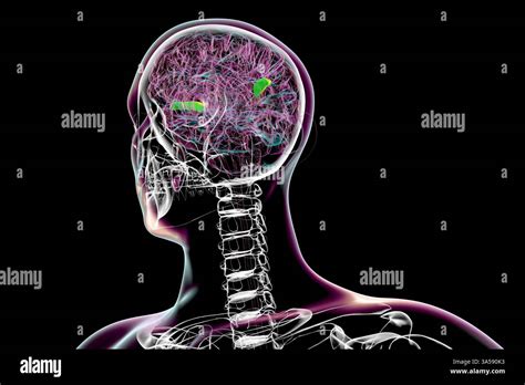 Illustration Of The Human Brain With The Transverse Temporal Gyri