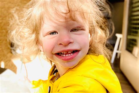 30 Facts About Rileyday Syndrome