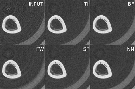 The Unprocessed Reconstruction Input As Well As Five Different Ring Download Scientific