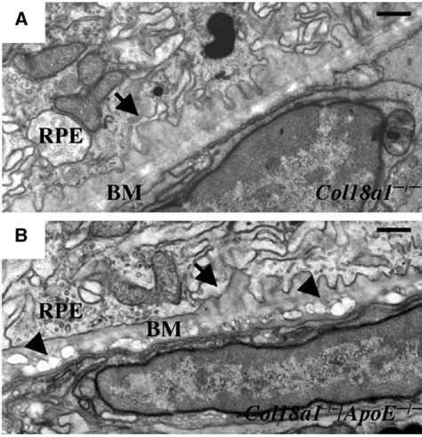 Sub Rpe Deposits In Col18a1− − Mice Contain Excess Bm Material A Download Scientific Diagram