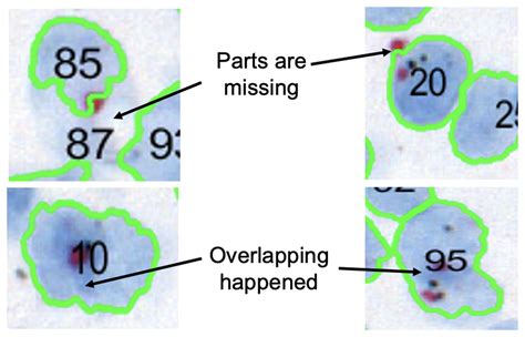 False Positives Of Singular Nuclei Which May Lead To Inaccurate Signal Download Scientific