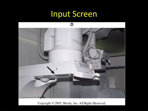 Fluroscopy Pptx Eye And Vision Conditions Diseases And Conditions
