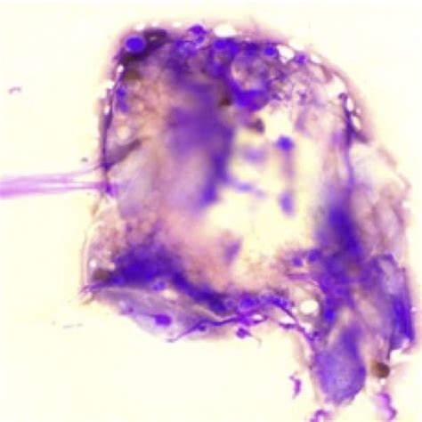 Cytology Using An Exudate From The Lesions Many Round Shaped Download Scientific Diagram