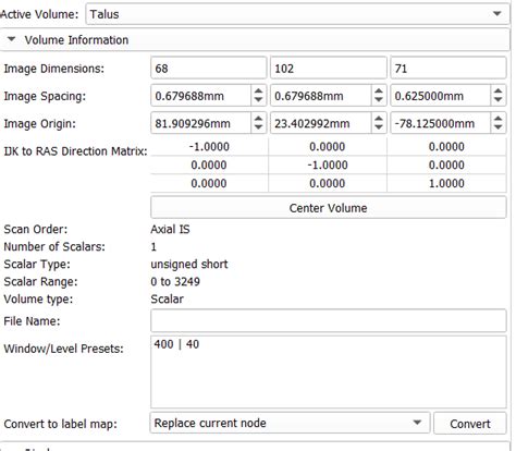 Autoscoper Preprocessing For Volumes And Transforms Slicerautoscoperm