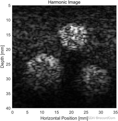 b模式超声成像仿真 matlab k wave仿真 matlab实现超声b扫描 csdn博客