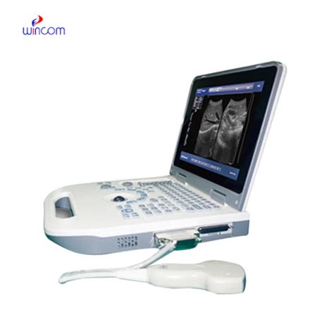Portable Full Digital Laptop Ultrasonic Diagnostic System Ultrasound
