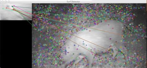 Resultant Image Of Surf Based Feature Description And Feature Matching