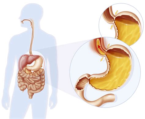 Sphincters Where They Re Found And Purpose
