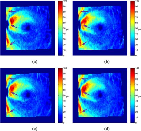 Mean Unsigned Error Over All The Four Surfaces For Independent And
