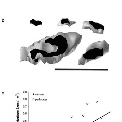 The Axonspine Interface A Schematic Illus Tration Of The Psd The