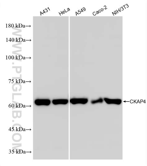 Ckap4 Antibody 84485 5 Pbs Proteintech