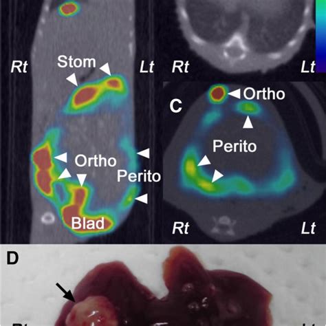 Spectct Fusion Images And The Liver Surface A Transaxial And