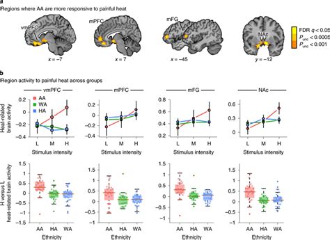 Results Of Whole Brain Voxel Wise Glm Analysis Showing Brain Regions