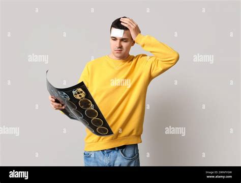 Young Man With Brain Concussion And Mri Scan On Light Background Stock