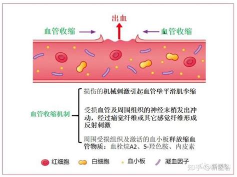 出血如何止？解析止血那些事 生理止血 知乎