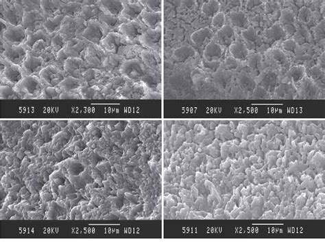 Enamel Etching Phosphoric Acid At Nicole Routh Blog