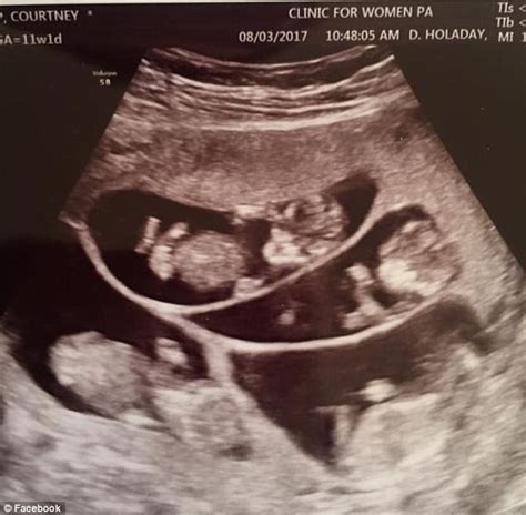 Alabama Mother Of Three Welcomes Sextuplets Daily Mail Online