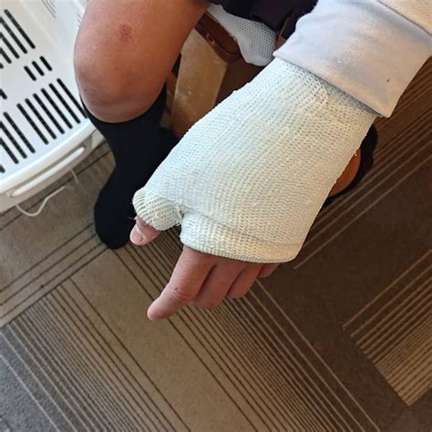 舟状骨骨折 広田接骨院