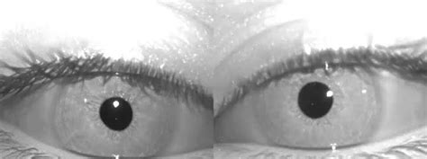 Insights Through Vision Tracking Eyes Using Opencv For Blink Detection Hackernoon